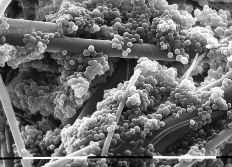 Discovery of a mechanism that allows Staphylococcus aureus to survive ...